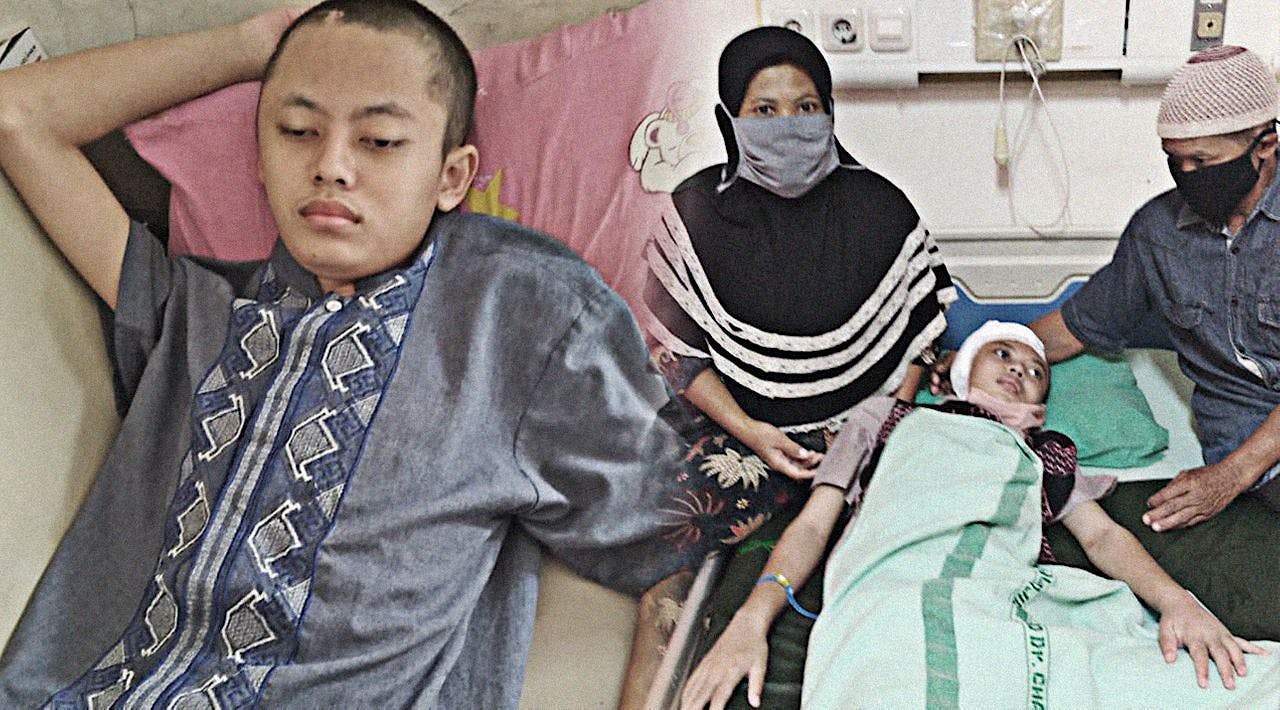 Sobahi Buta Akibat Penumpukan Cairan di Otak