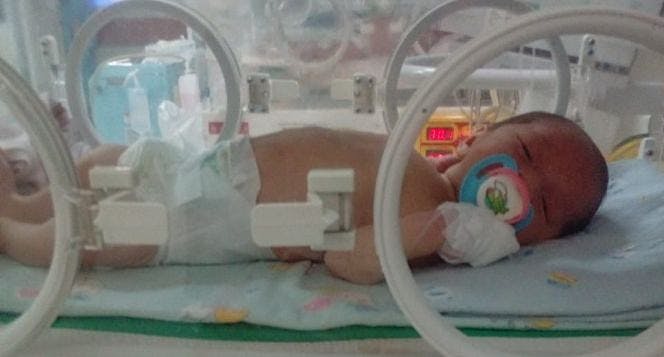 Bantu Ghaisan Untuk Operasi Hisprung