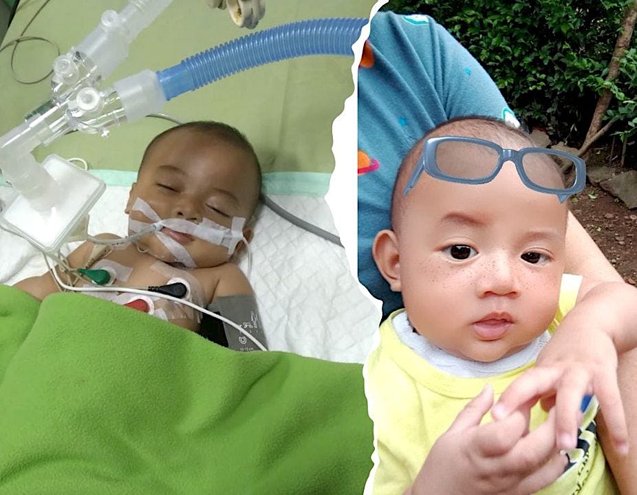 Alami Peradangan Otak, Bantu Kesembuhan Fazriel