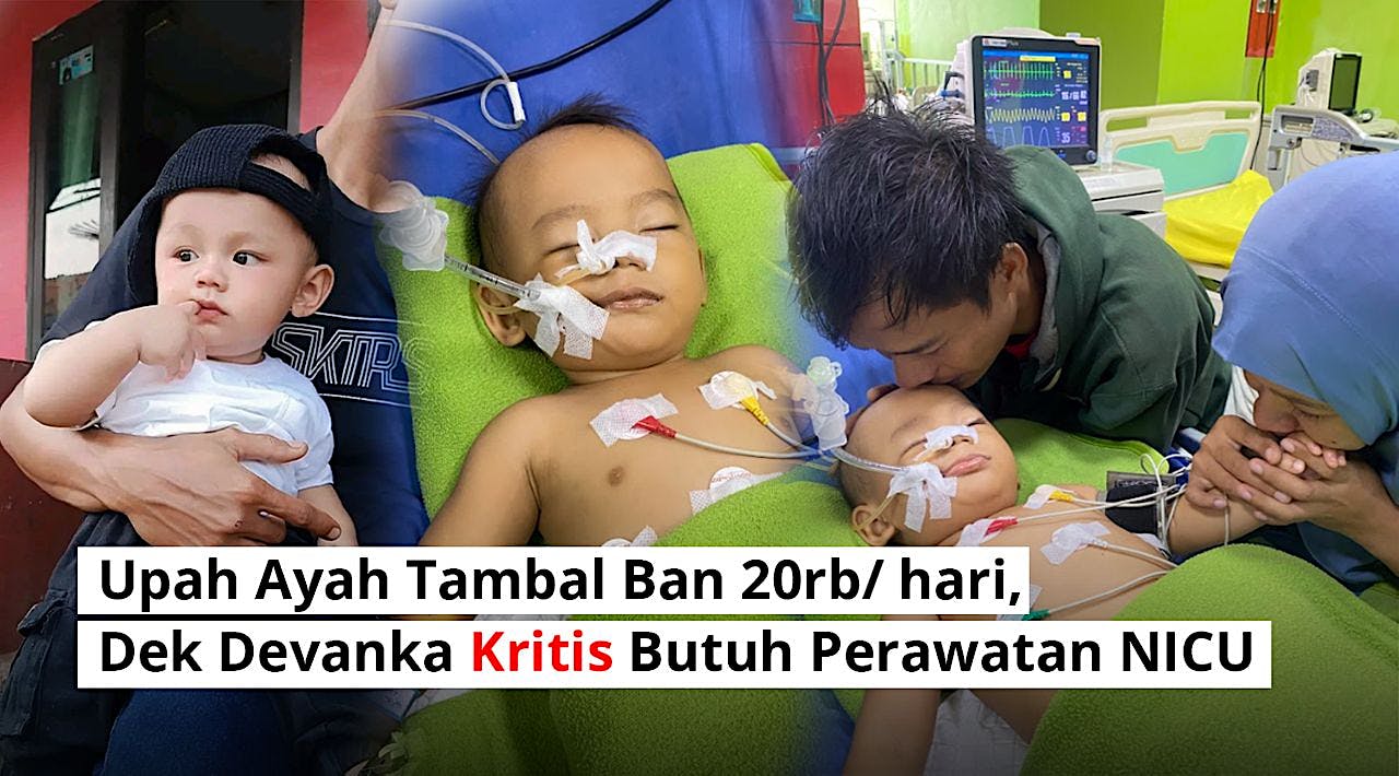 URGENT!! Bayi Koma Direnggut Komplikasi Otak Akut