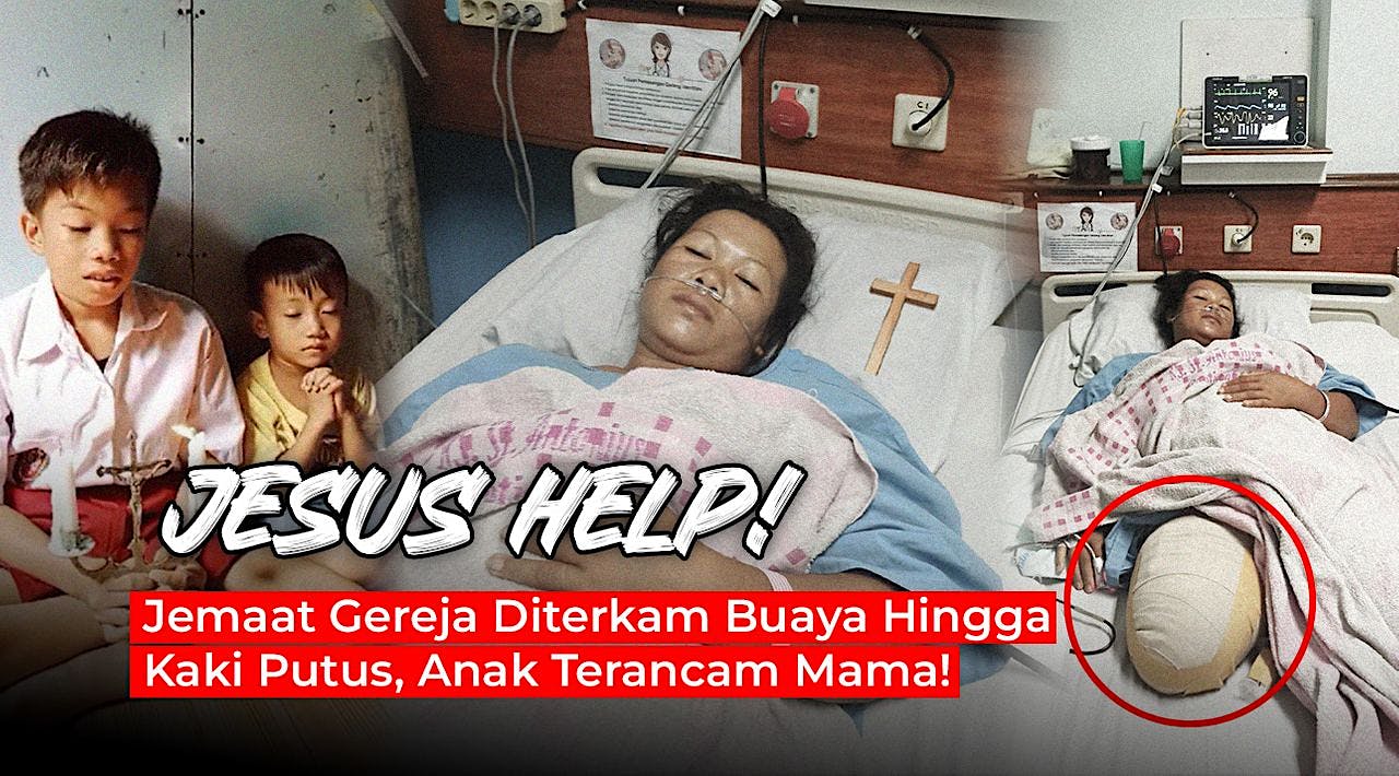 Kaki PUTUS Diterkam Buaya–Tuhan Yesus, Tolong Mama
