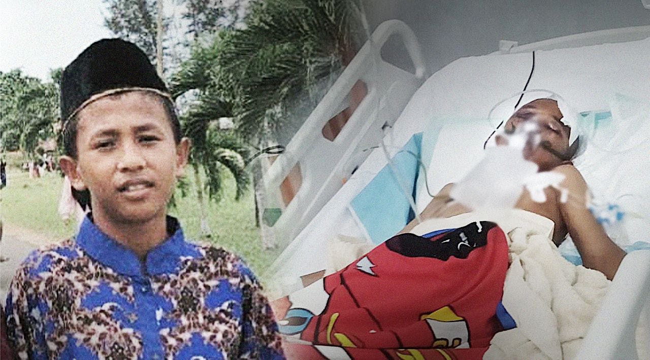 Kecelakaan Motor, Irga Koma & Pendarahan Otak