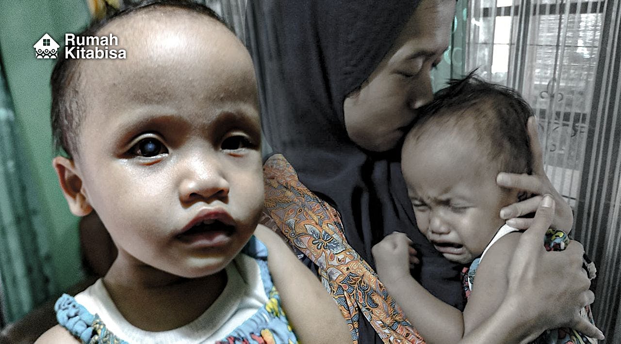 Kisah Pilu Penjual Es Rawat Anaknya Sakit Otak