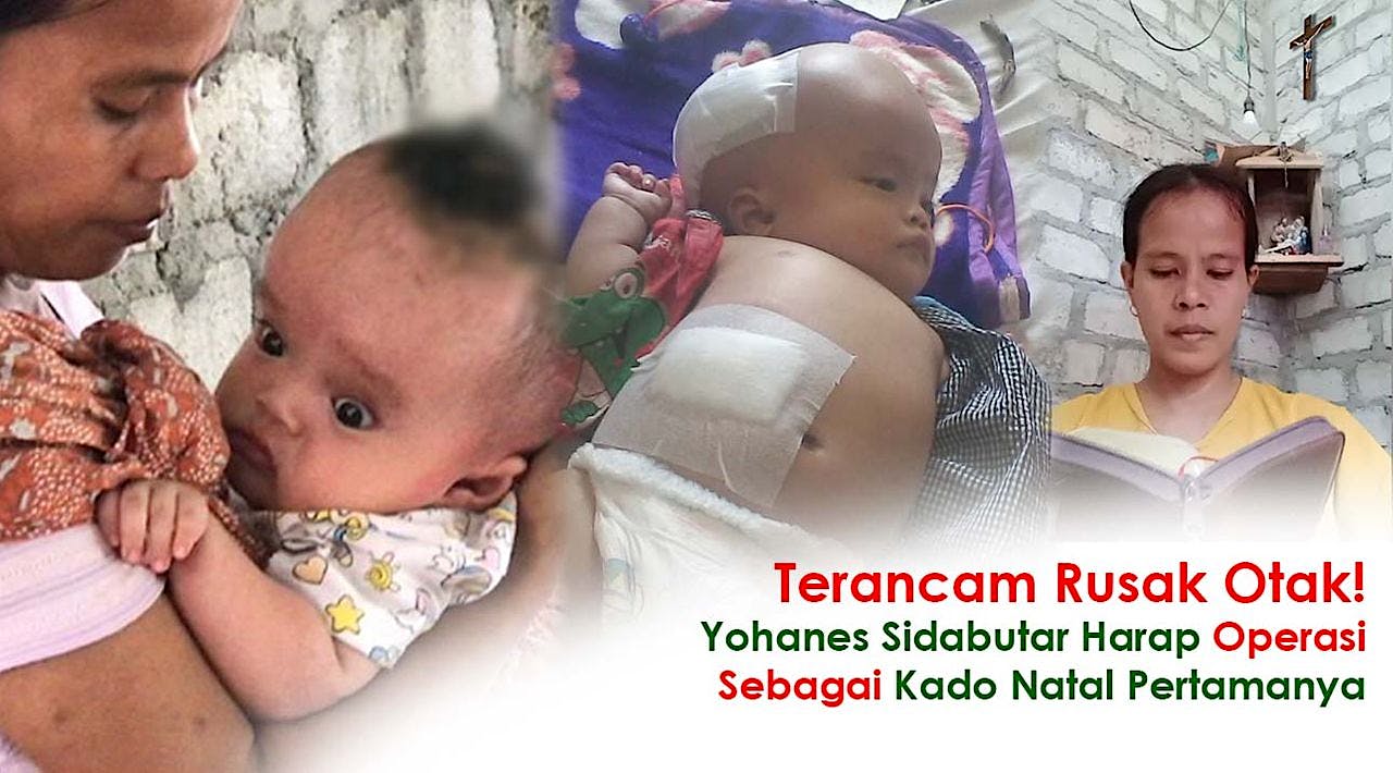 Operasi Cairan di Otak ‘Tuk Kado Natal Yohanes